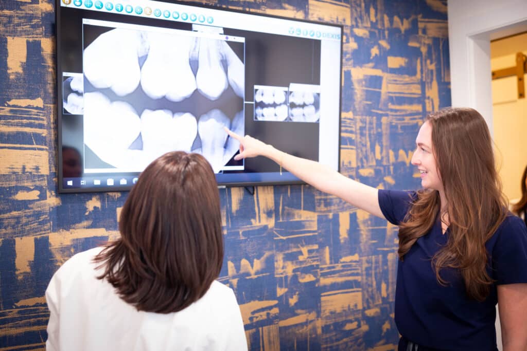 Tooth Fillings Summit NJ | Dental Fillings, Tooth Colored Restorations